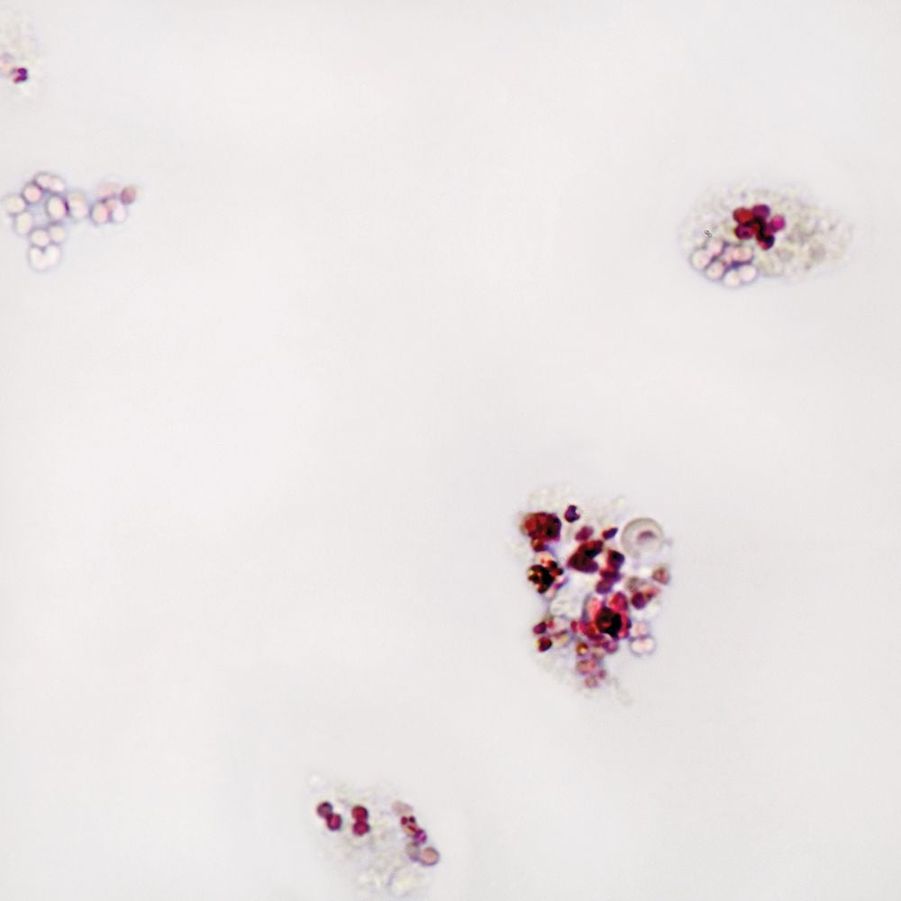 Gloeocapsa Microscope