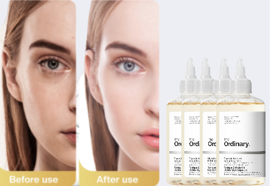 Glycolic Toning Solution, Glycolic Sour 7% Toning, KeepThe Skin Moist ...