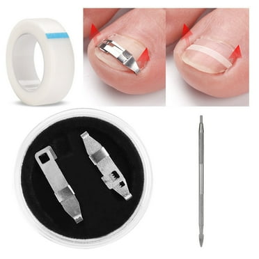 Professional Pedicure Tool Set: Ingrown Toenail Corrector Device with ...