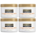 Gold Bond Rough & Bumpy Daily Skin Therapy, 8 oz (Pack of 4) - Walmart.com