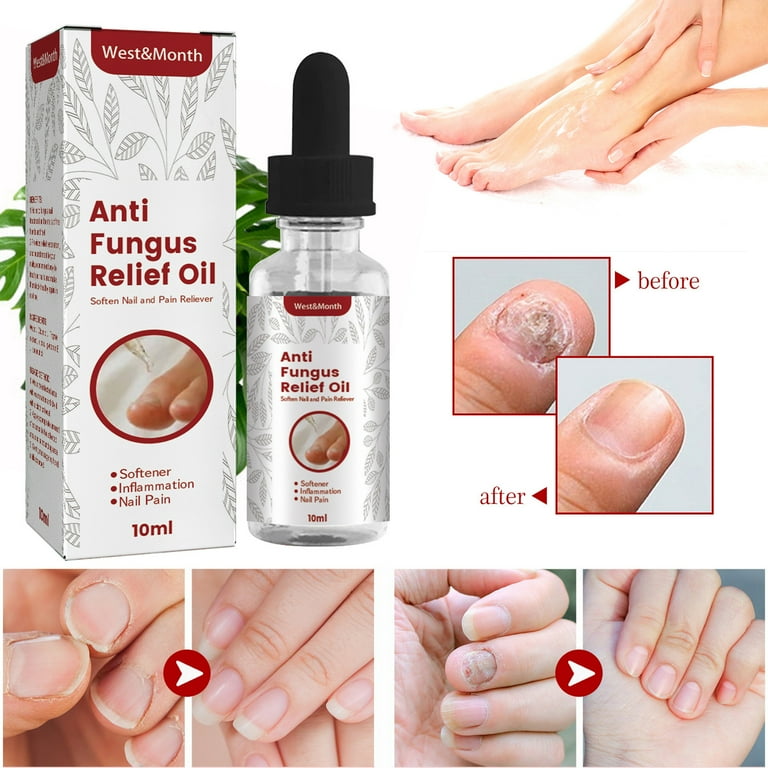 Kerasal fungal nail renewal treatment store