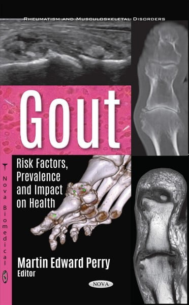 Pre-Owned Gout : Risk Factors, Prevalence and Impact on Health ...