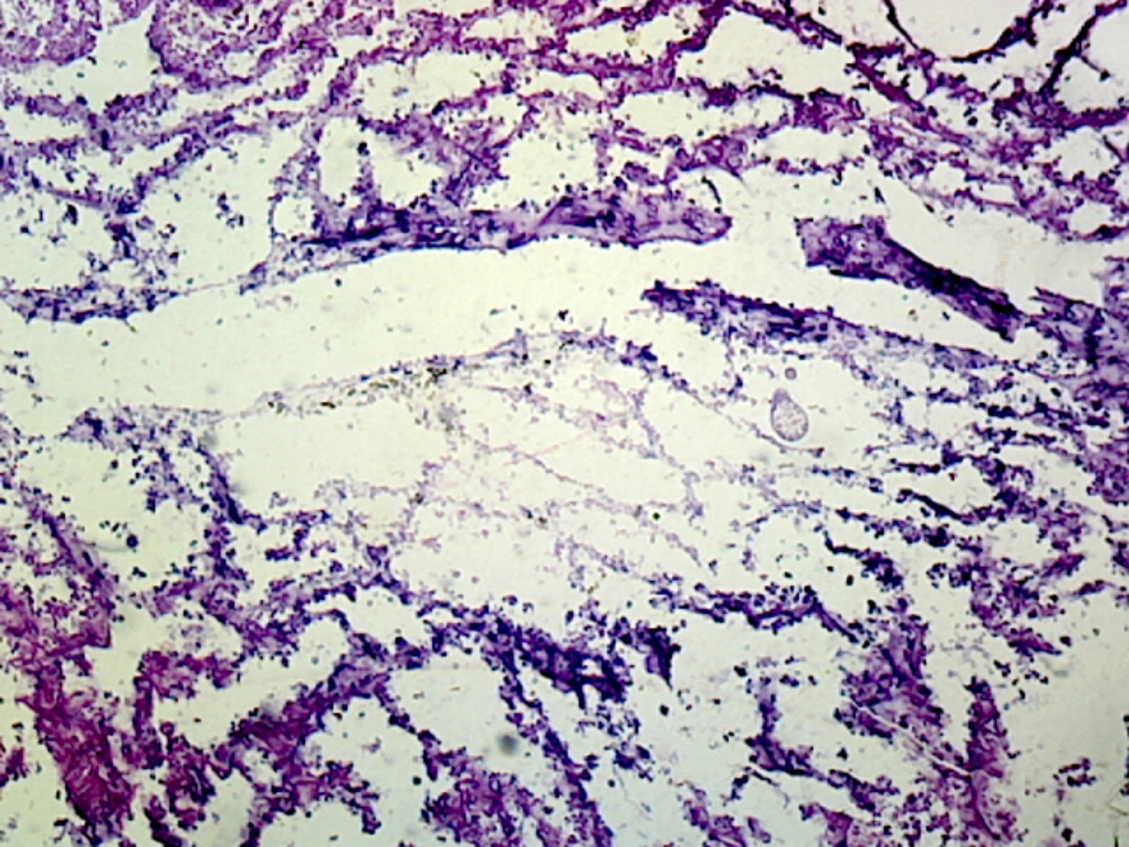 Grantia (Scypha); Longitudinal Section by Go Science Crazy - Walmart.com