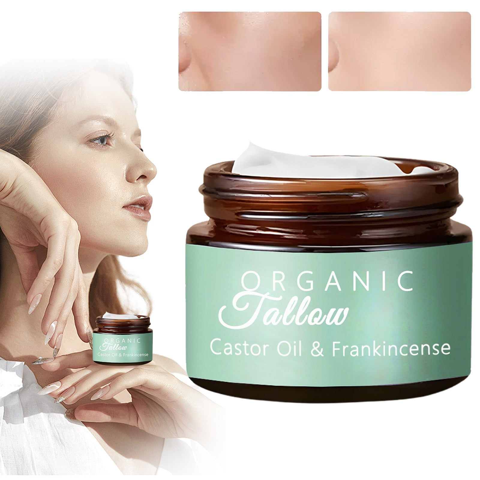 Grass-Fed Beef Tallow with Frankincense & Castor Oil - Organic Moisturizer for Skin, Face & Body ...