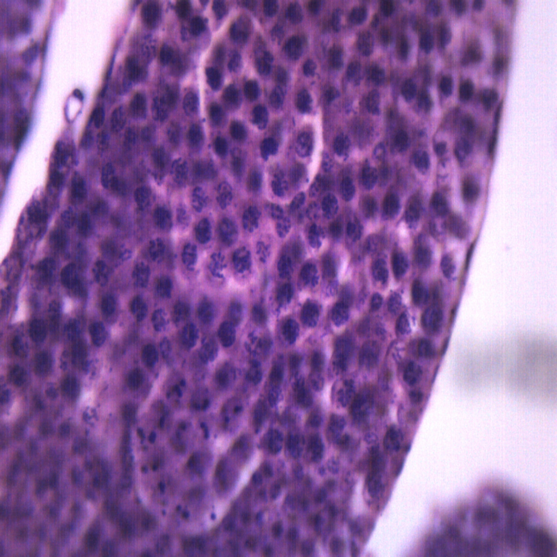 Grasshopper Meiosis, Wholemount - Prepared Microscope Slide - 75 x 25mm ...