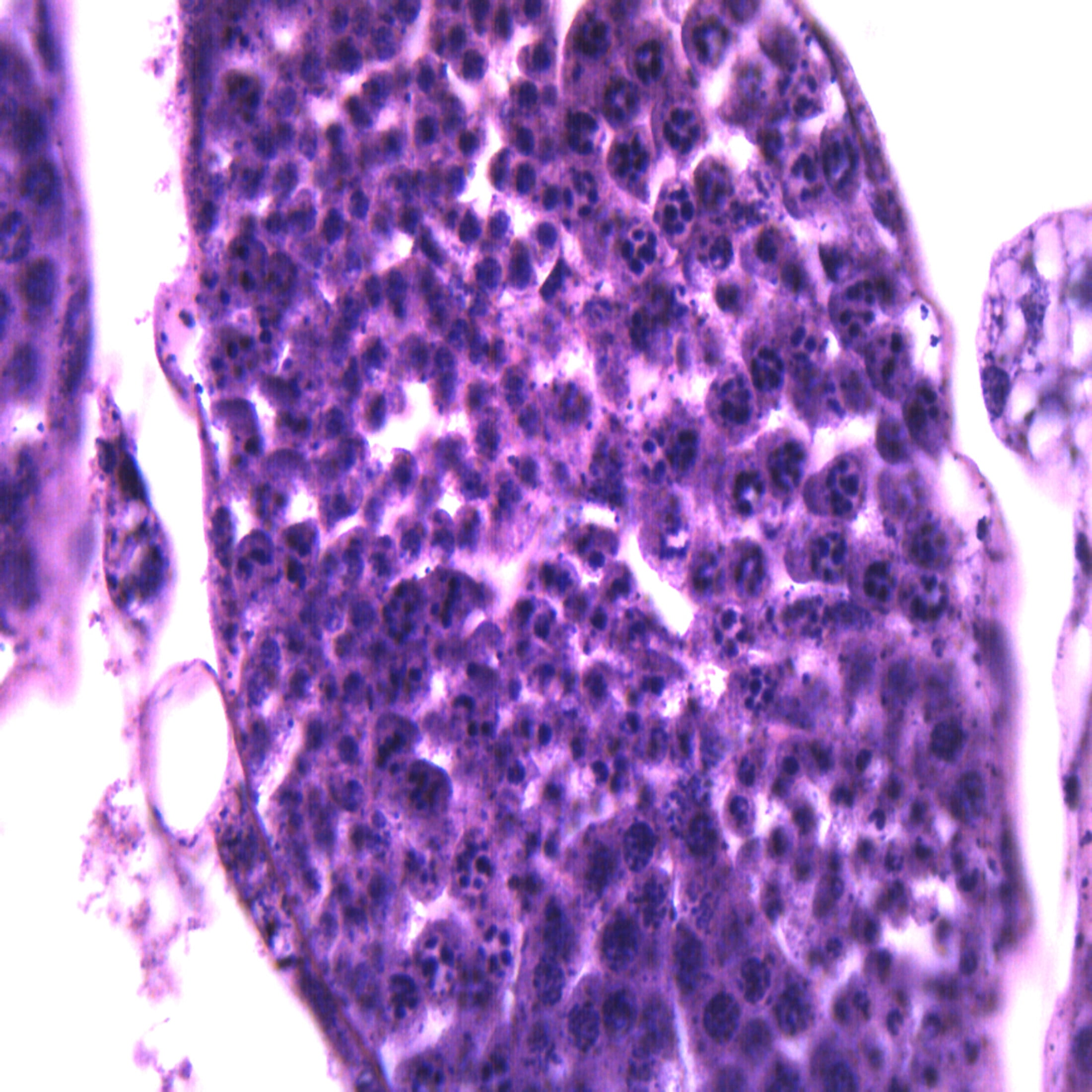 Grasshopper Testis, Wholemount - Prepared Microscope Slide - 75 x 25mm ...