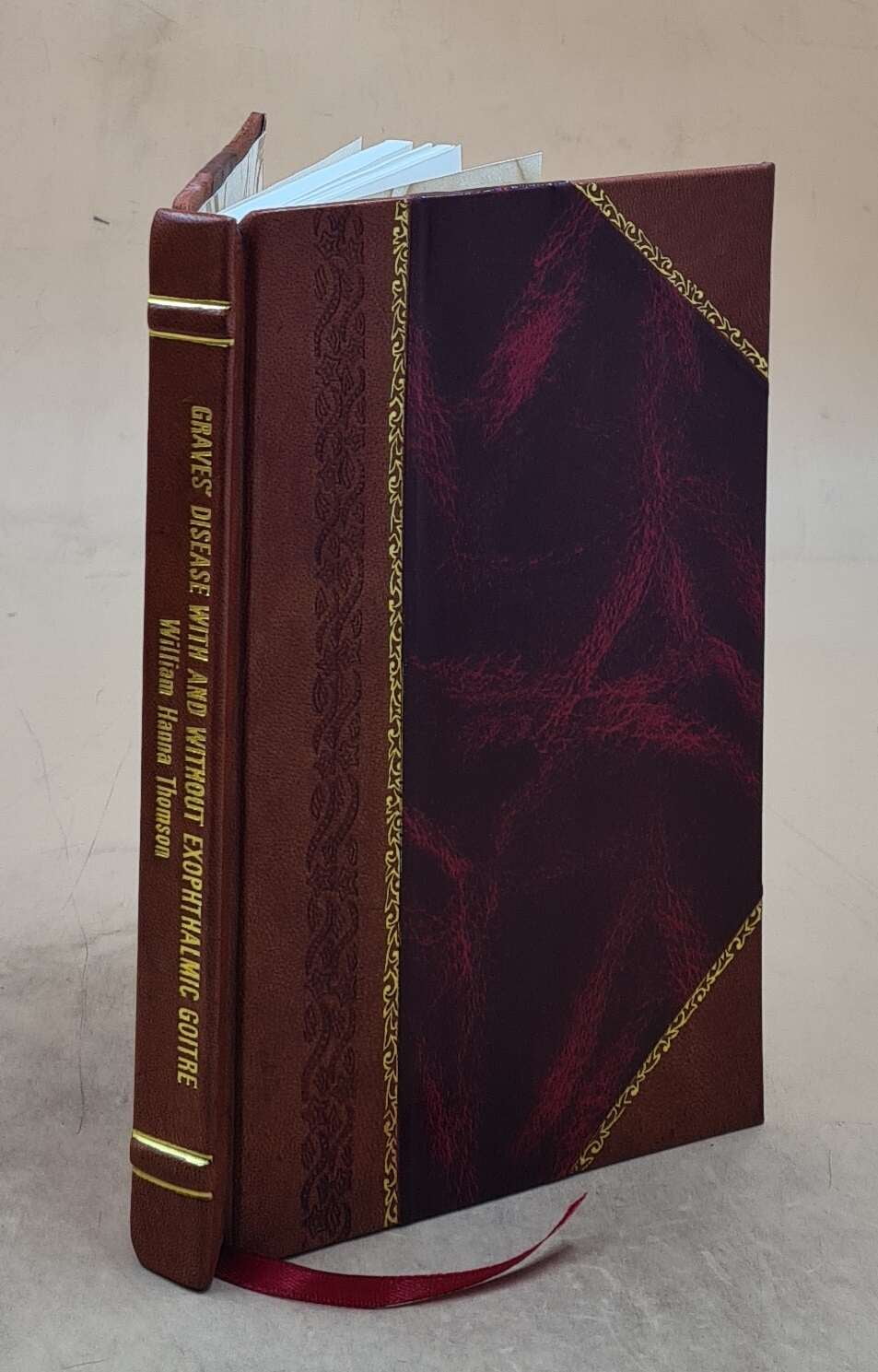 Graves' disease with and without exophthalmic goitre by William Hanna ...