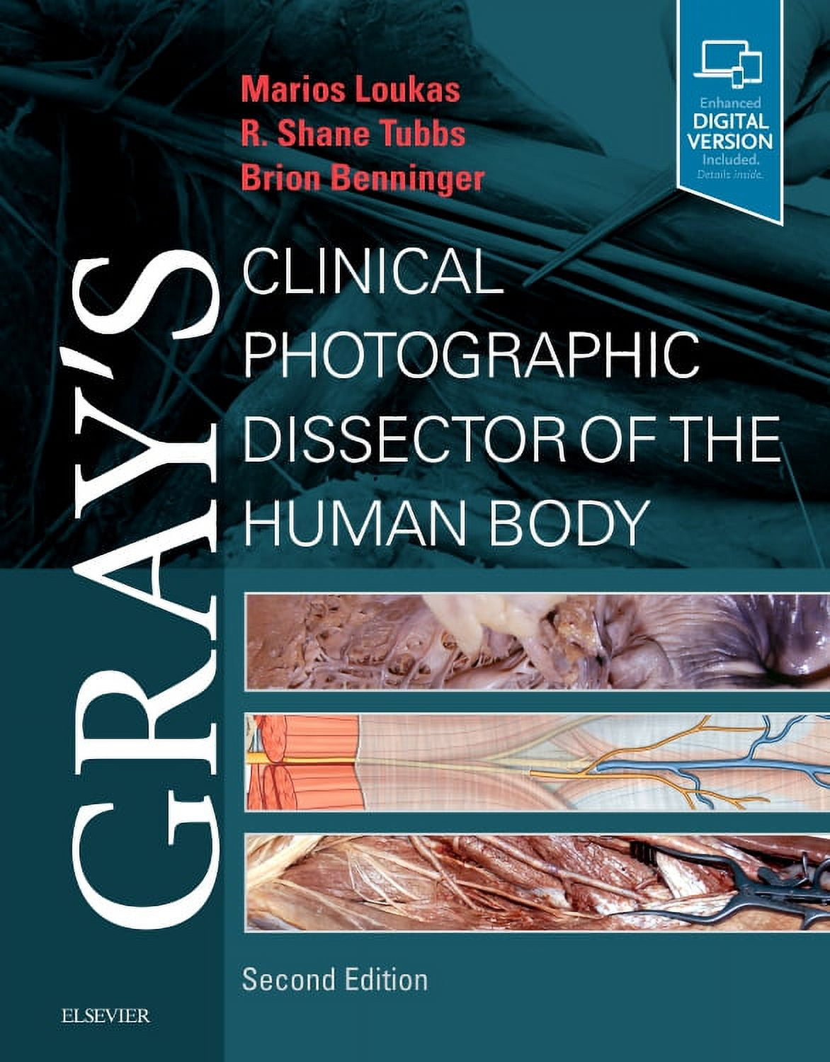 Gray's Clinical Photographic Dissector of the Human Body - Walmart.com
