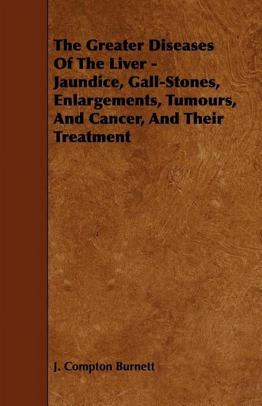 The Greater Diseases of the Liver - Jaundice, Gall-Stones, Enlargements ...
