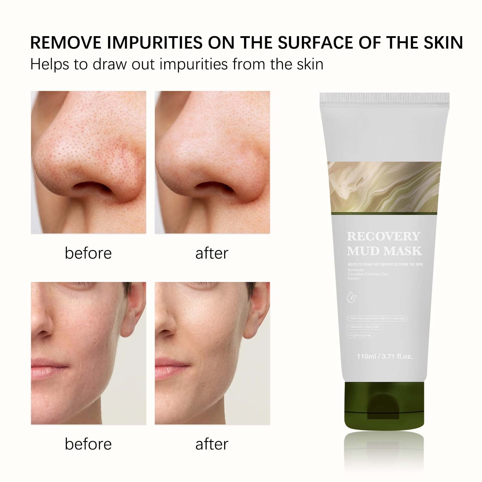 Green Tea Cleansing Mask | Blackhead Remover & Whitehead Treatment | Oil Control | Deep ...