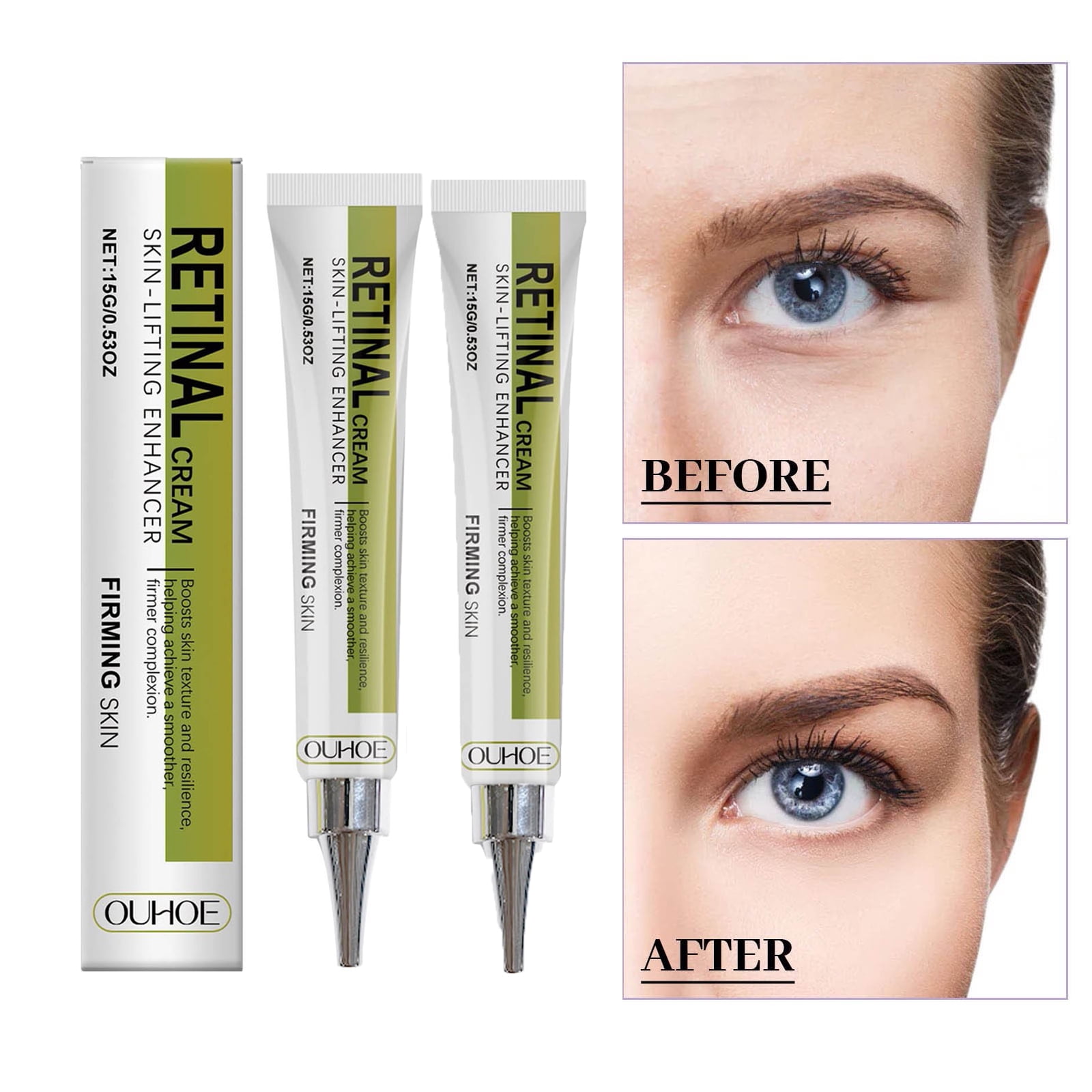 ONLYEOR Wrinkle Firming Face Cream, Retinol & Hyaluronic Acid Cream ...