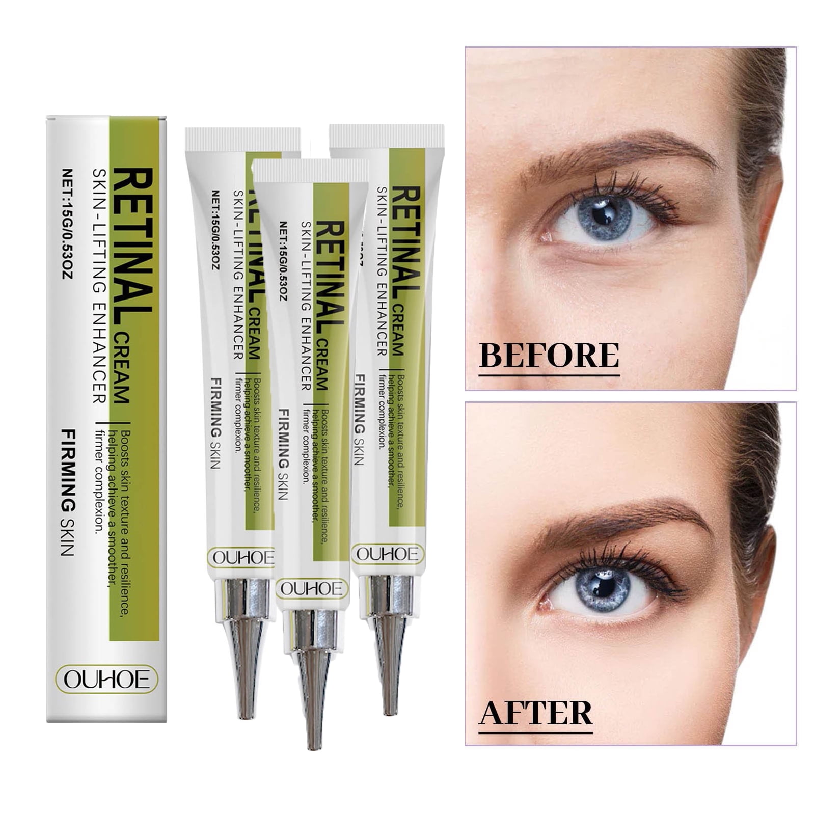 ONLYEOR Wrinkle Firming Face Cream, Retinol & Hyaluronic Acid Cream ...