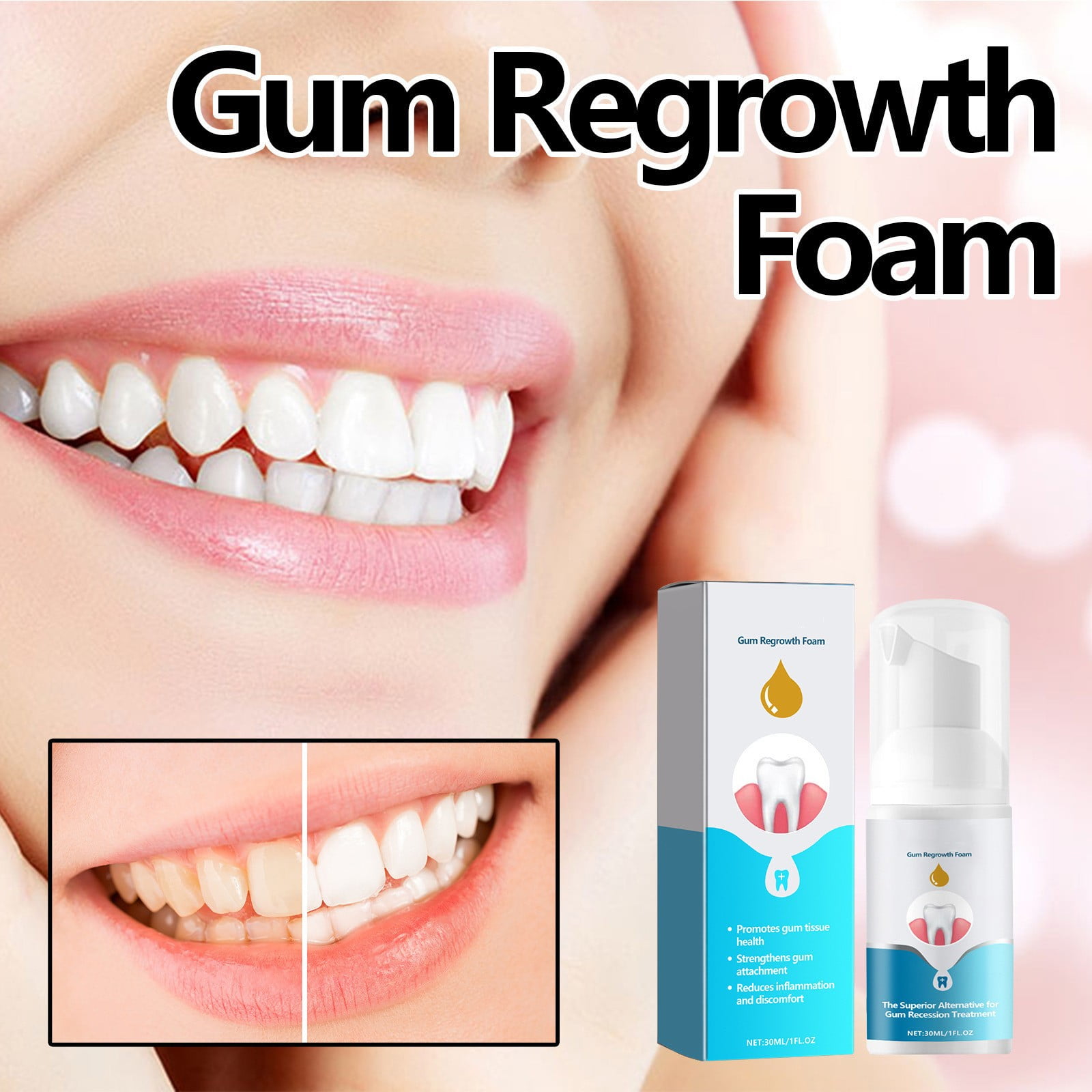 Gum Regrowth Foam | Natural Tissue Regeneration | Strengthens Gum ...