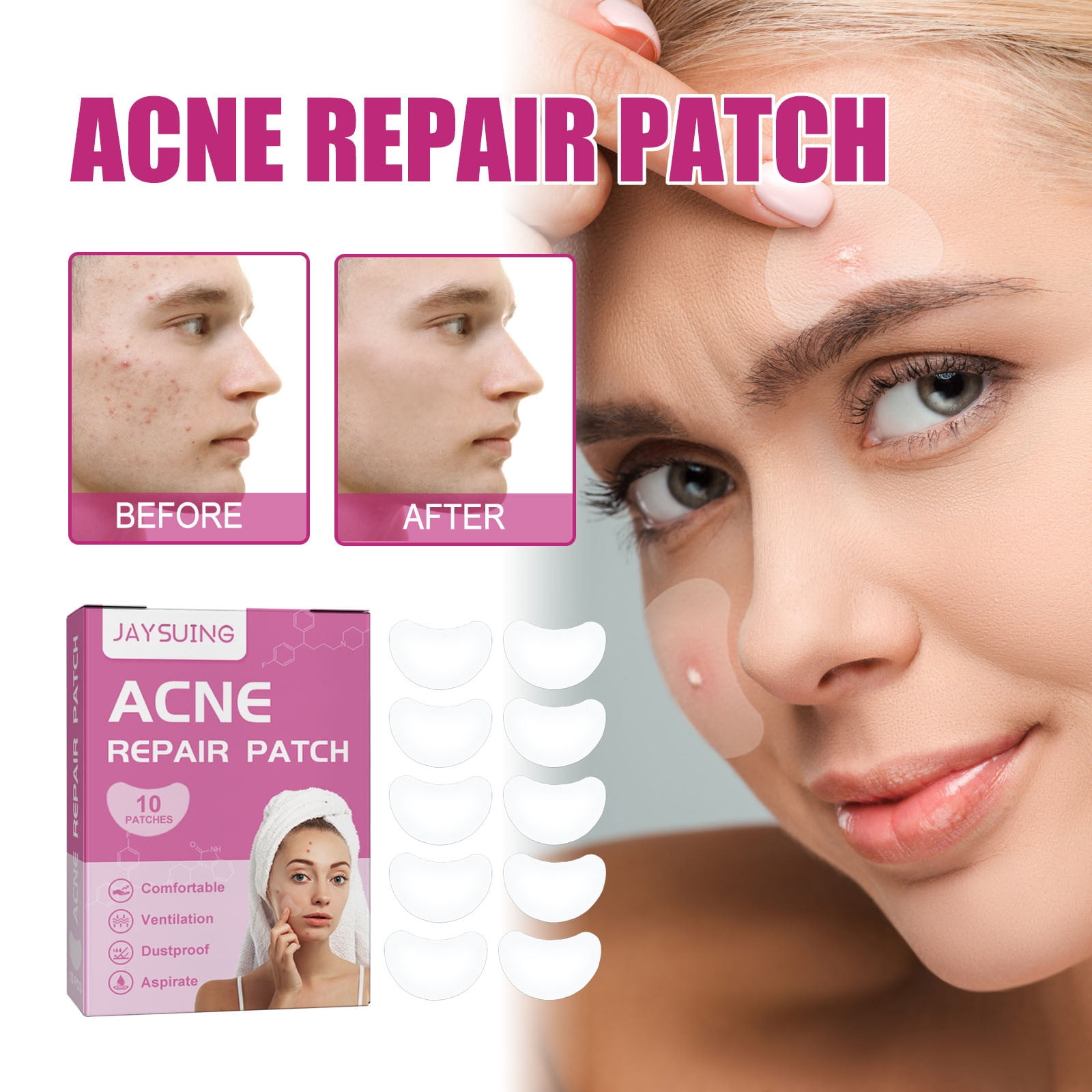 Gzwccvsn Acne Patch,Hydrocolloid Acne Patch Oil Control Acne Patch，mild ...