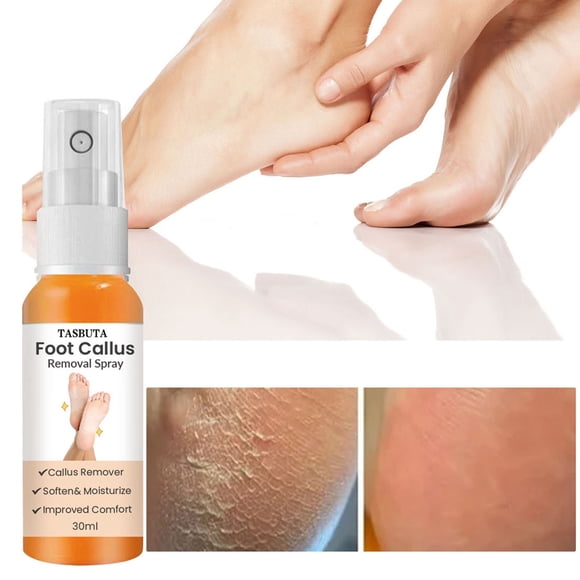 Foot Peeling Spray