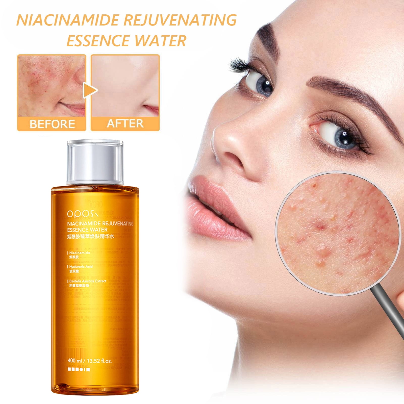 Gzwccvsn Moisturizing Toner, Facial Exfoliation，Astringe Pores ; Skin ...