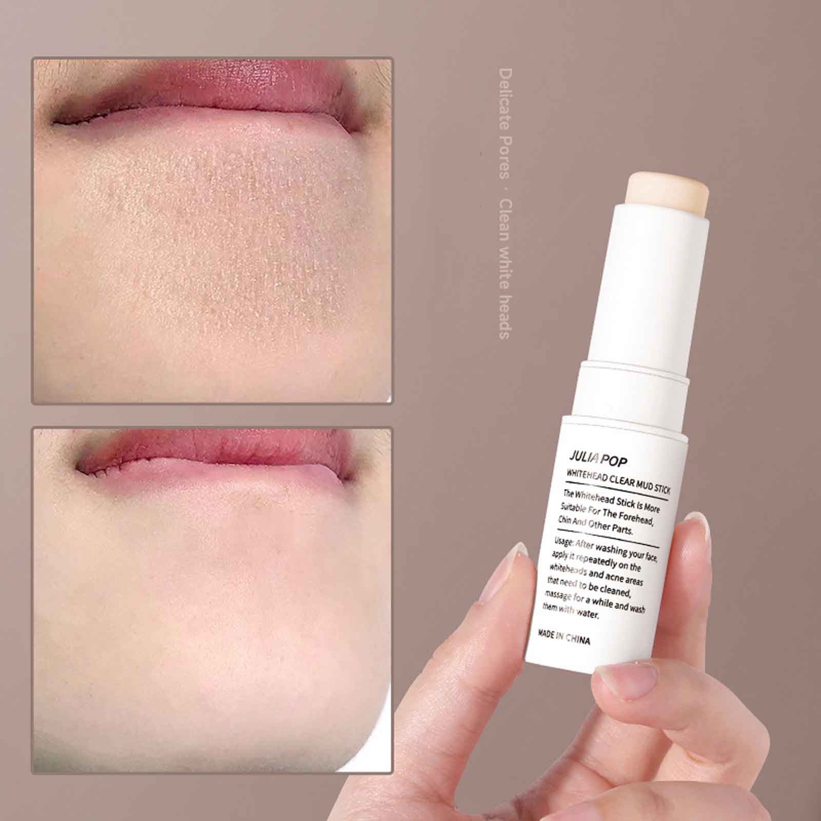 Gzwccvsn Whitehead Clear Mud Stick For Face Deep Clean Clogged Pores ...
