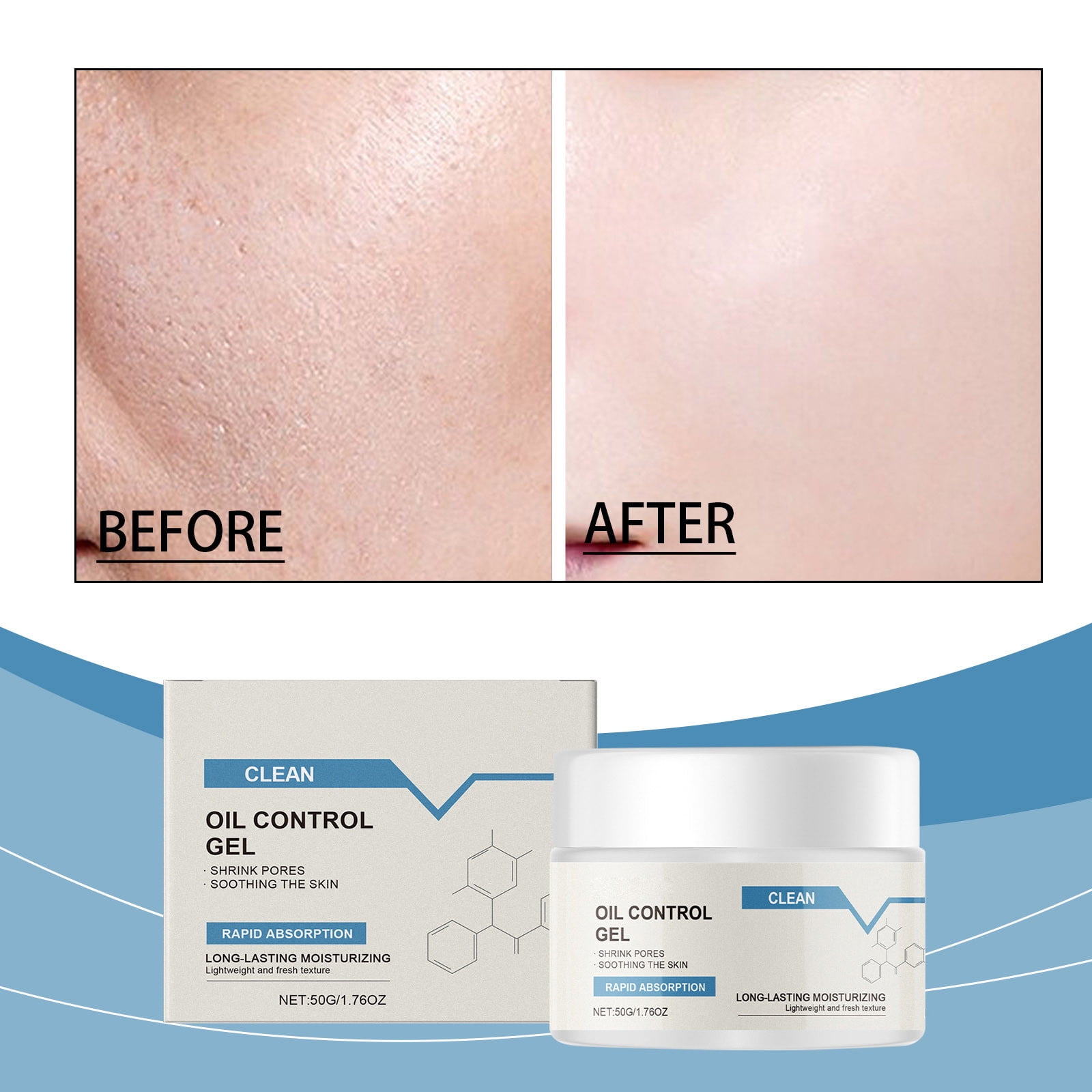 HAOLAOYULU An Naturals Active Moist Skin Spray for Stomach Oily Skin ...