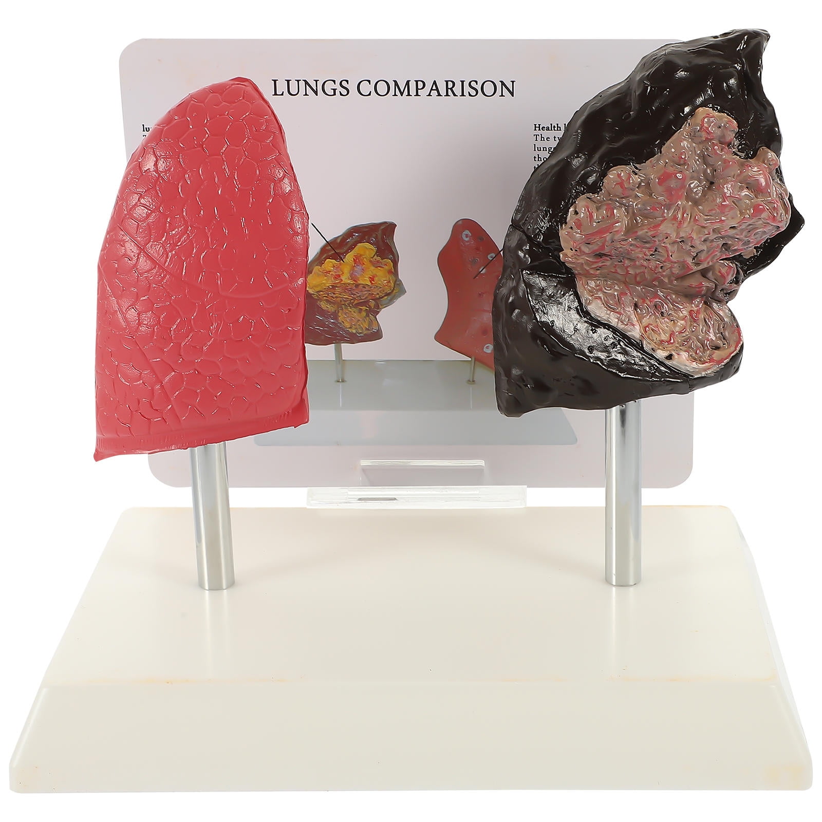 HEMOTON 1 Pc PVC Smoking Lung Model for Anatomy and Demonstrations in ...