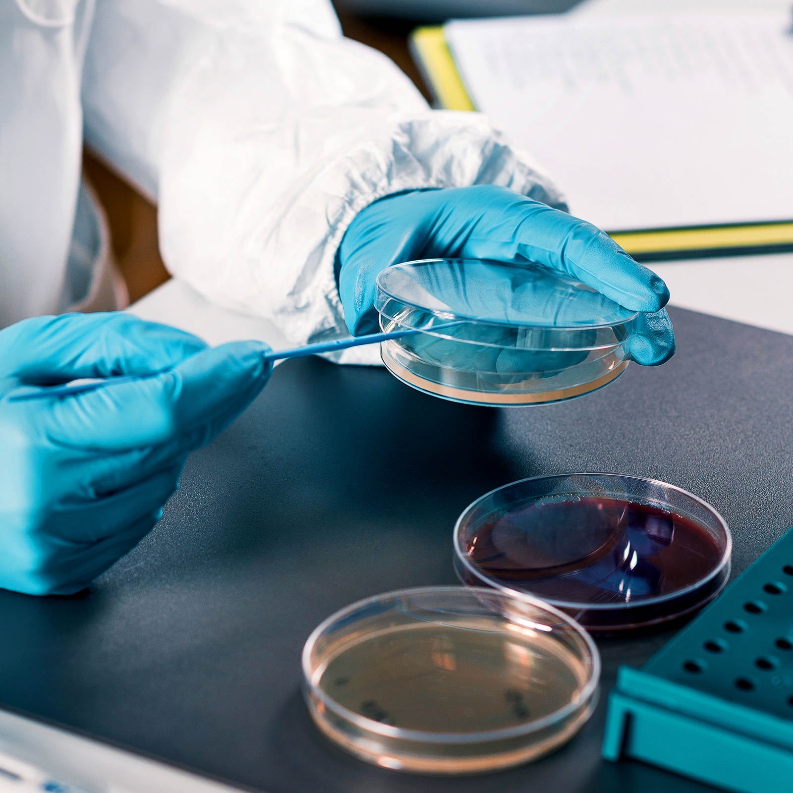 HEMOTON 20 Pcs Microbiology Nutrient Agar Plate Professional Plates ...