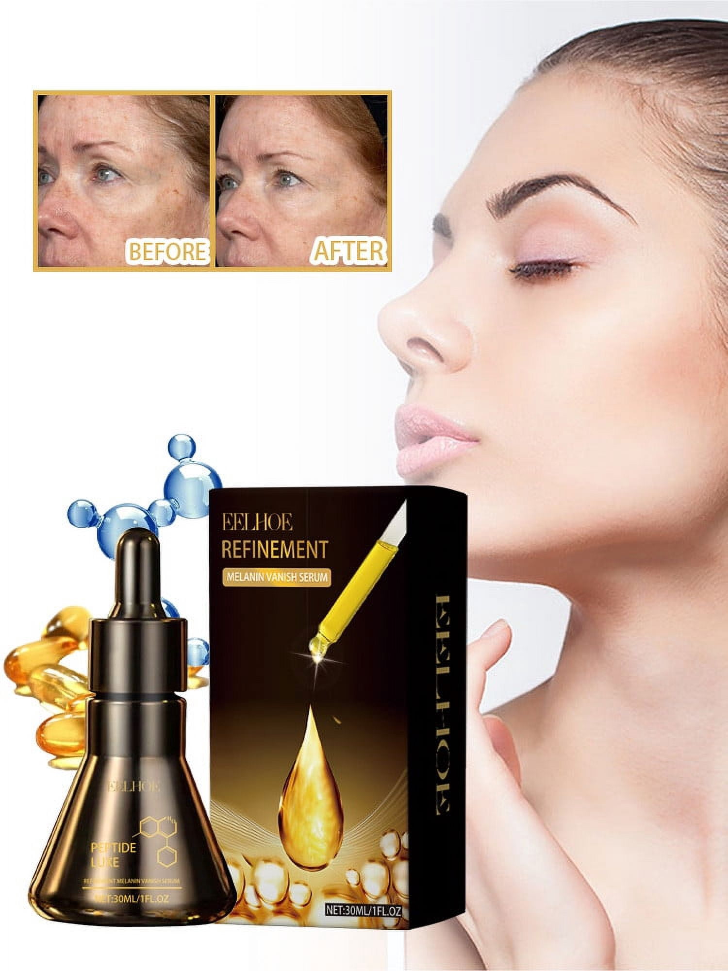 HHBEAUTY Dark Spot Correcting Glow Serum, Lighten-Up Skin brightening ...