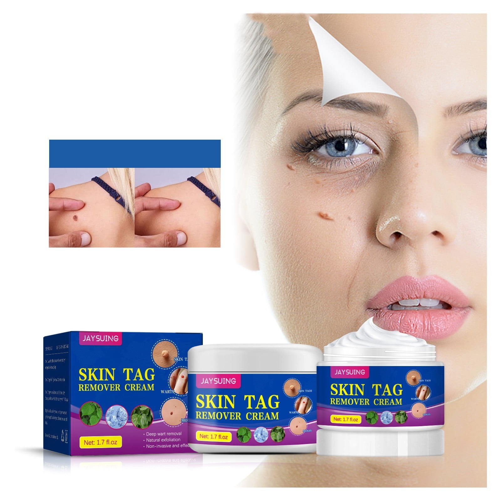 HML Gram Wart Skin Application Keyou Body Skin Foot Hand Neck Care ...