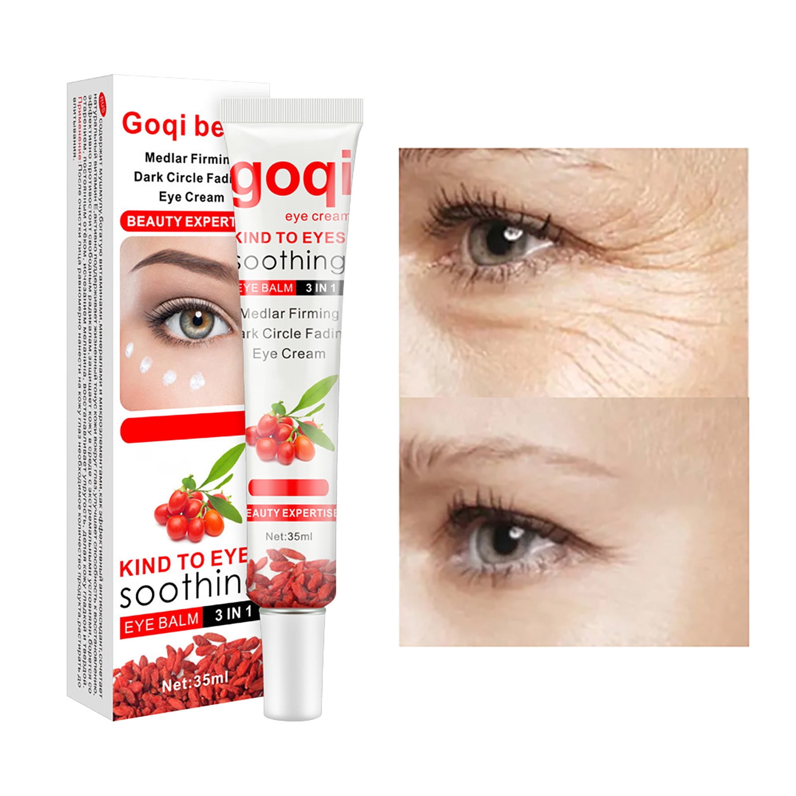 HMPEAIIY Goji Berry Eye To Eye Bags And Dark To Fade Crow'S Feet And ...