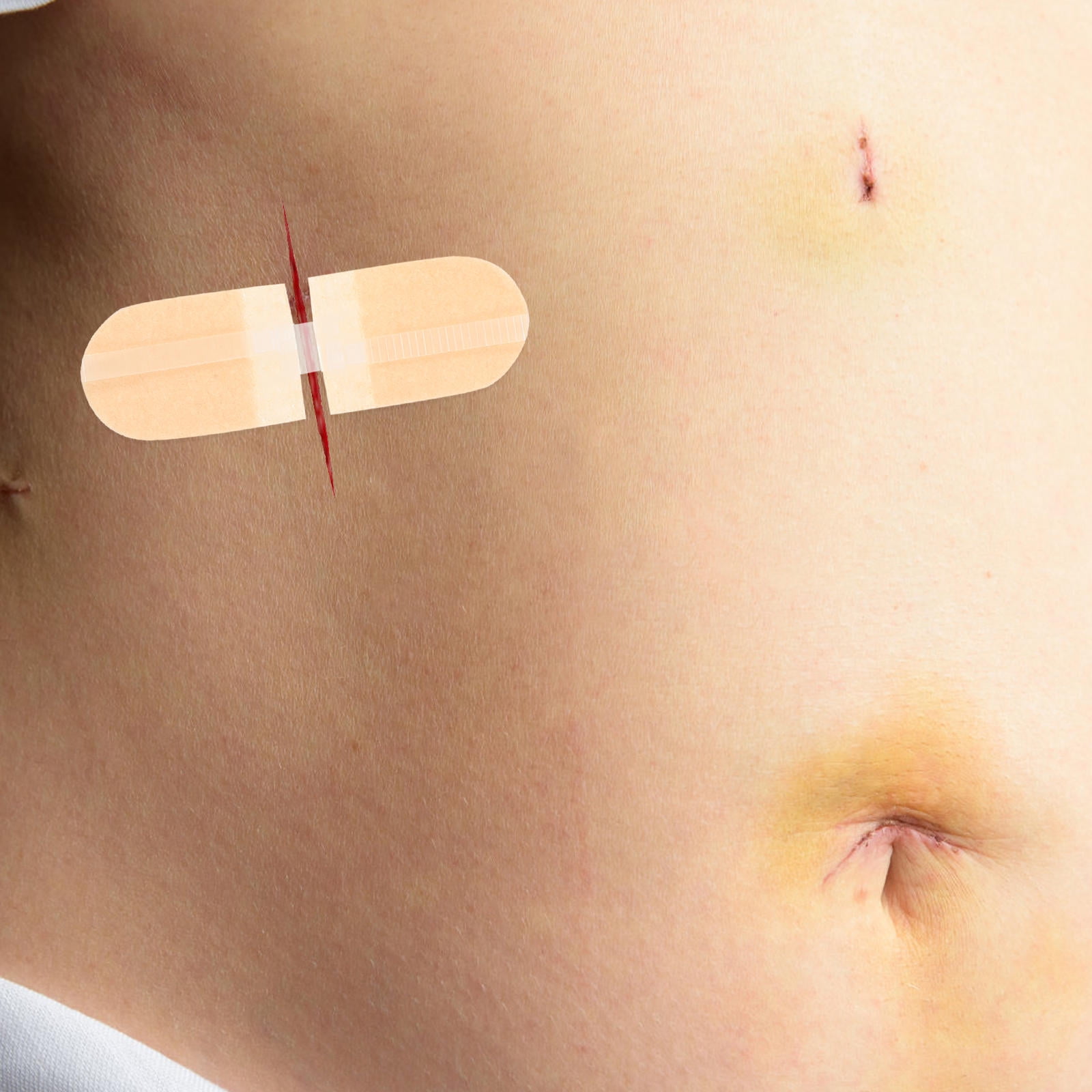 3 Pcs No-sew Tape Strips for Closure Butterfly Closures Bandages ...