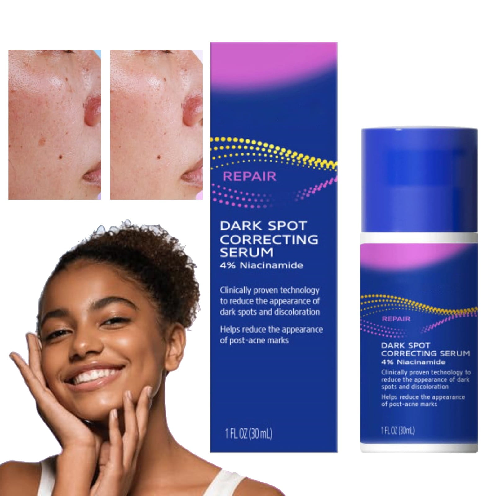 HOT SALE!! Dark Spot Correcting Face Serum, Dark Spot Correcting Serum ...