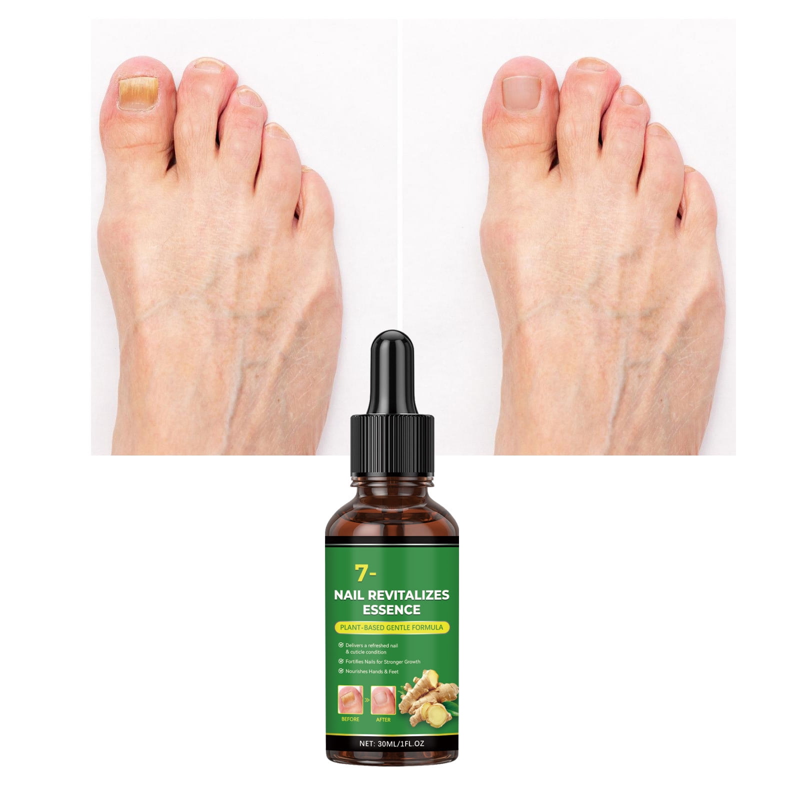 HWRETIE Ginger Nail Care Essence Softens Brightens Nails Hand and Foot ...