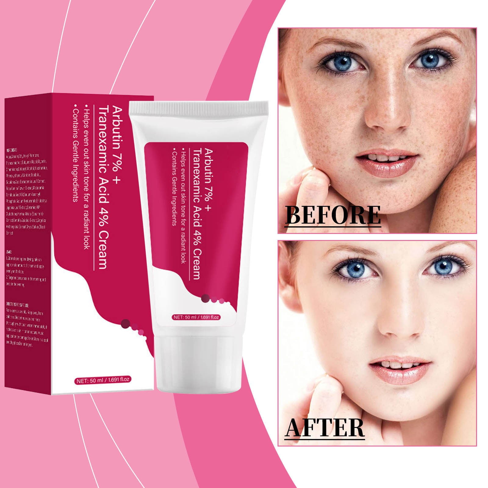 HYLLai Tranexamic Acid Face Cream with 7% Arbutin, Dark Spot Corrector ...