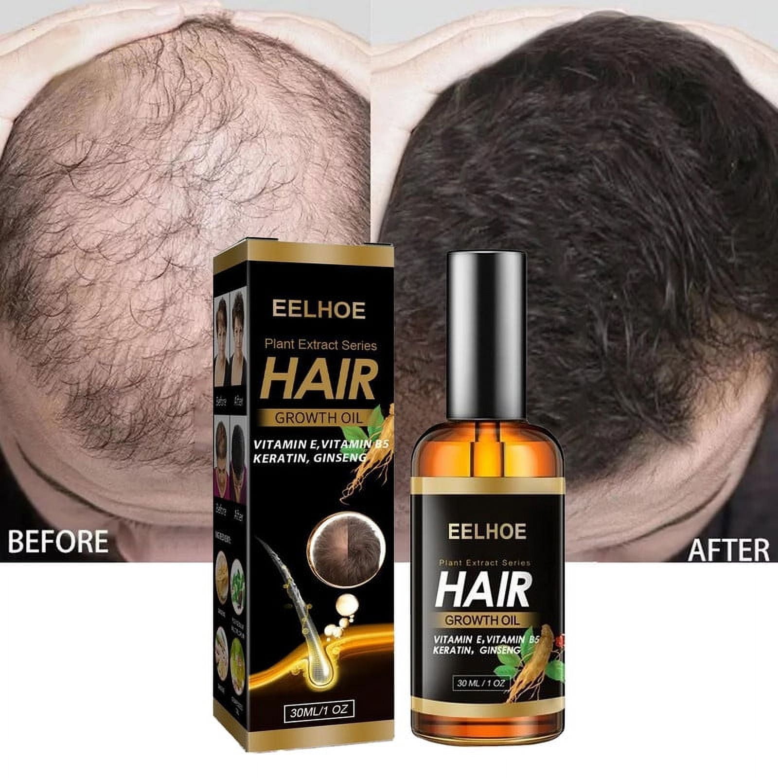 Hair Growth Oil Biotin Hair Growth Serum Hair Loss Treatment For