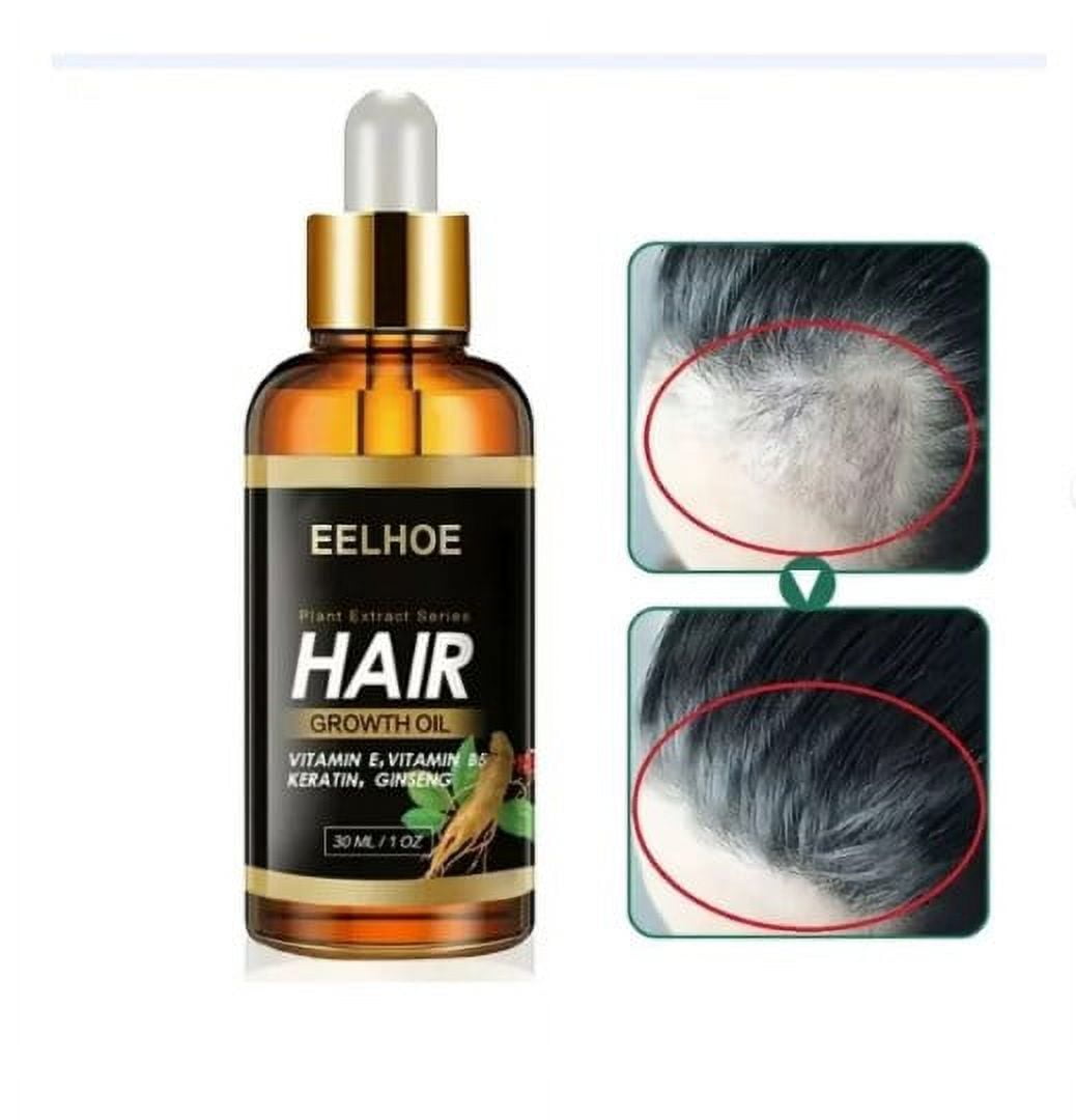 Hair Growth Oil, Biotin Hair Growth Serum Hair Loss Treatment for ...
