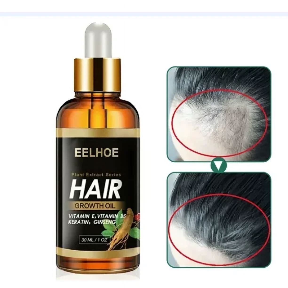 Hair Growth Oil Prevent Thinning Hair Biotin Hair Growth Serum Hair