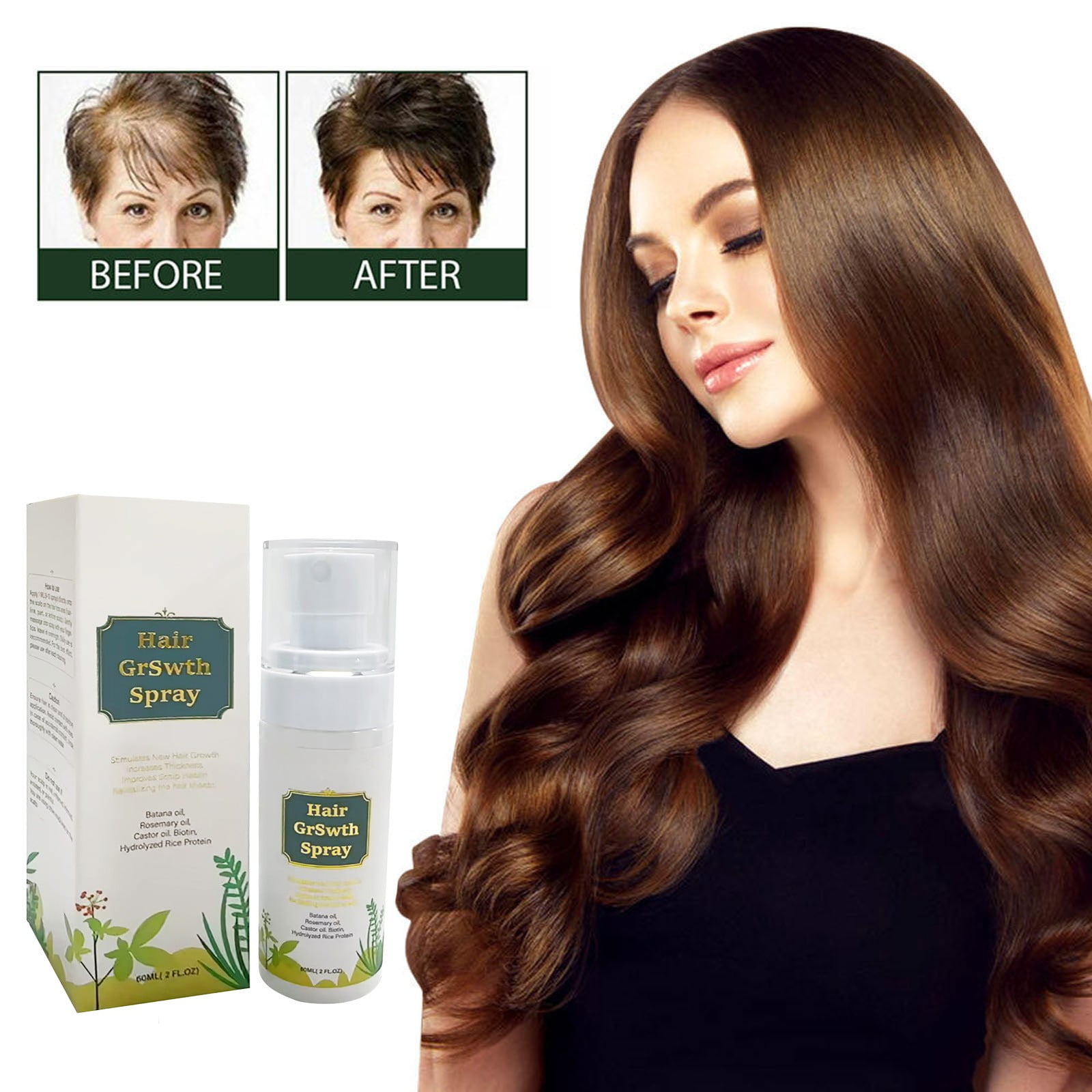 Hair Growth Serum, Biotin+Caffeine Scalp Treatment, Men's & Women's, 60ml, Natural Oil Spray ...