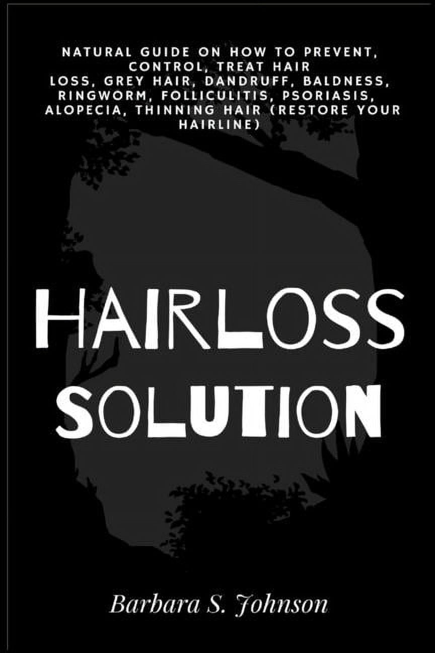 Hairloss Solution: Natural Guide on how to prevent, control, treat hair ...