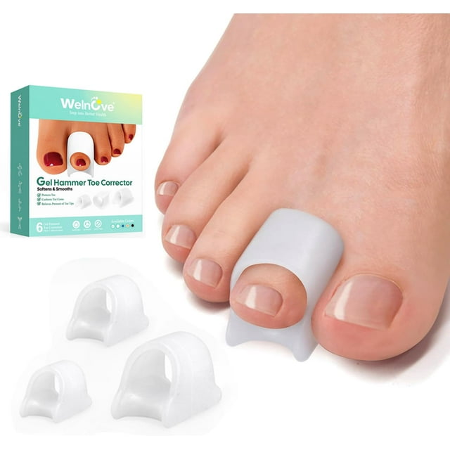 Hammertoe Corrector- 10 Pieces Toe Splints Realign Bent, Curled ...