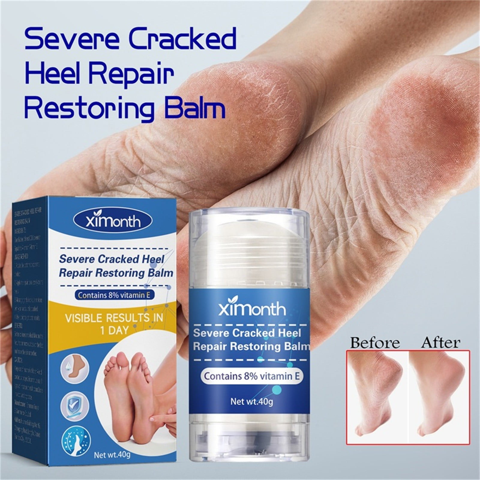 Hand Cream, Cracked Skin Repair Cream, Foot Cream, Moisturising Foot ...