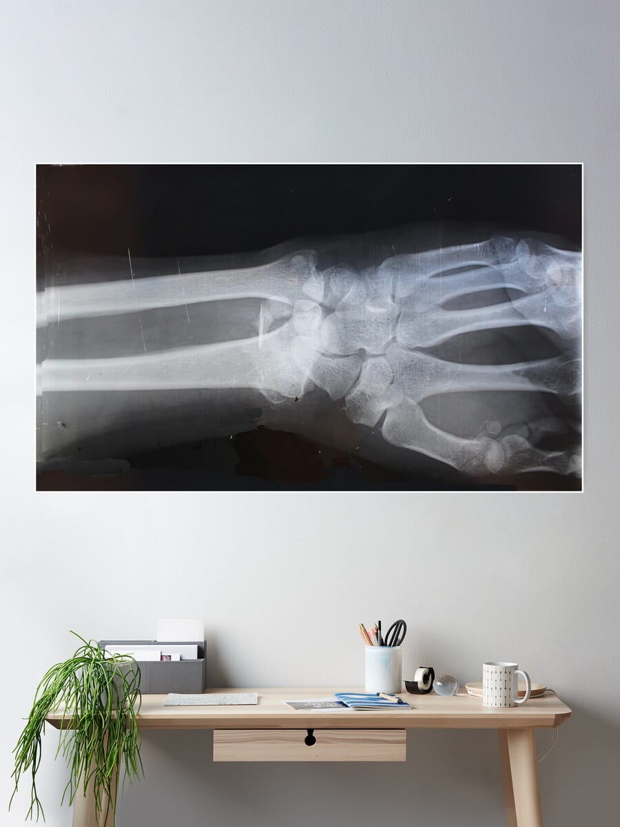 Hand Xray To Hang In The Bathroom Poster Wall Art, Modern Wall Decor ...