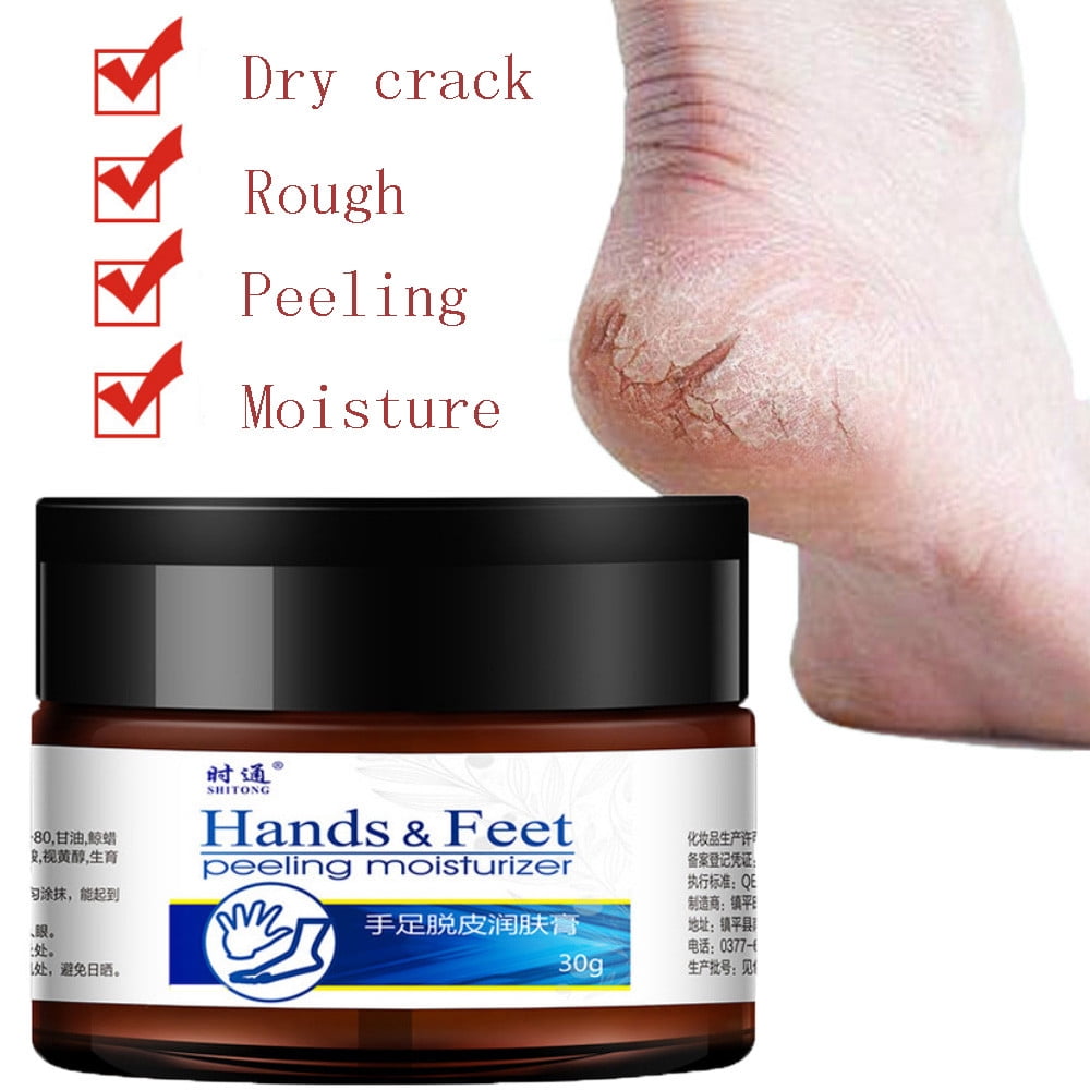 Hand and foot peeling moisturizing cream removes dead skin, calluses, peeling, dry hands and ...