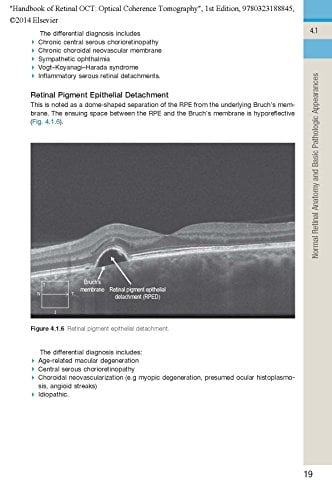 Handbook of Retinal OCT: Optical Coherence Tomography, 1e Duker MD, Jay ...