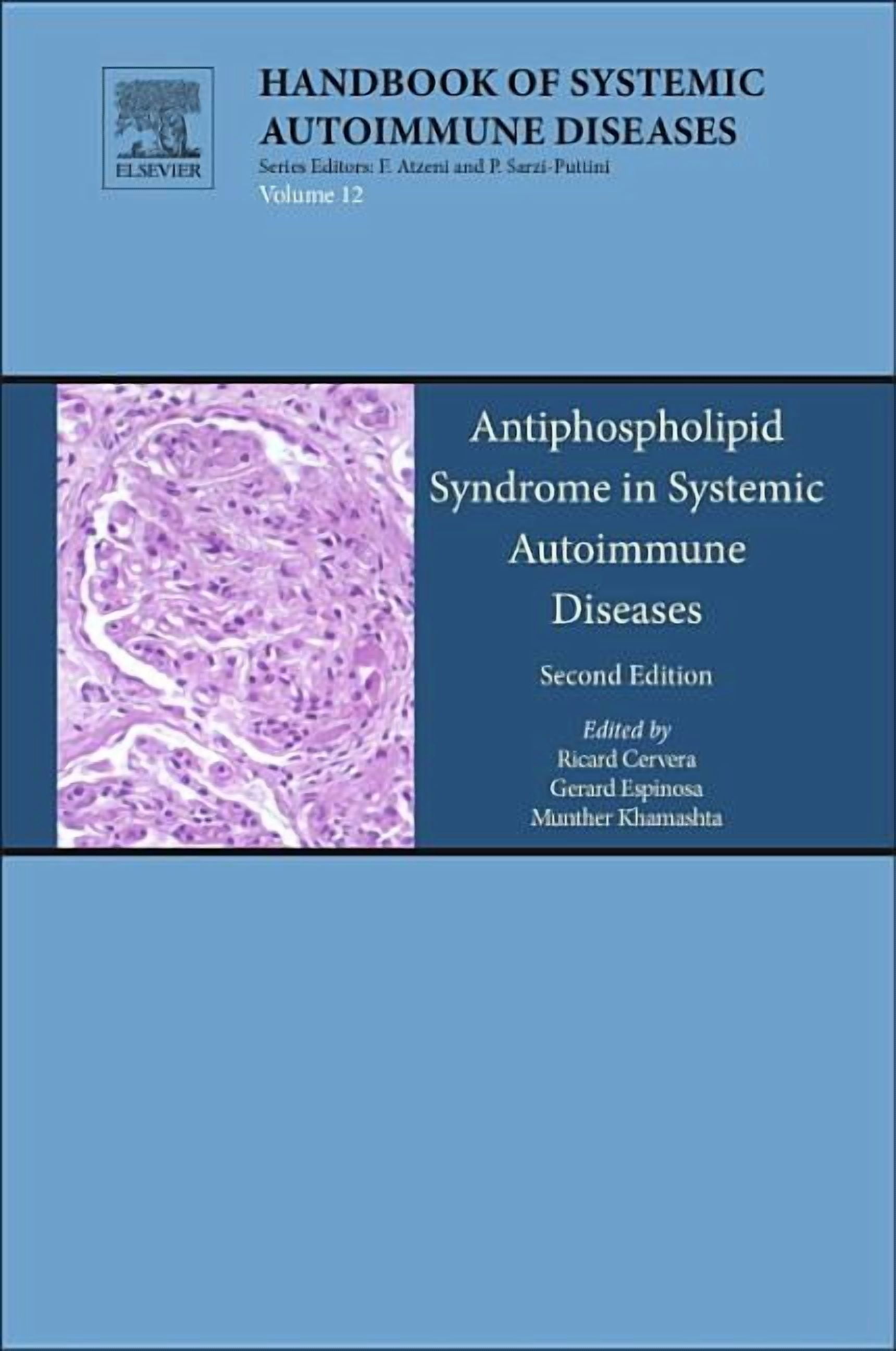 Handbook of Systemic Autoimmune Diseases Antiphospholipid Syndrome in ...