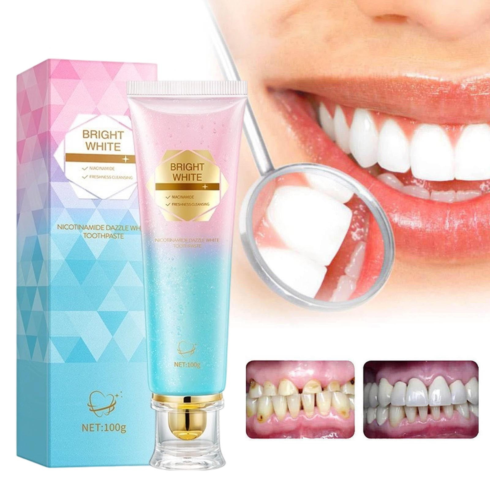 Hauiodp Whitening Toothpaste for Adults, Niacinamide Intensive Whiten ...