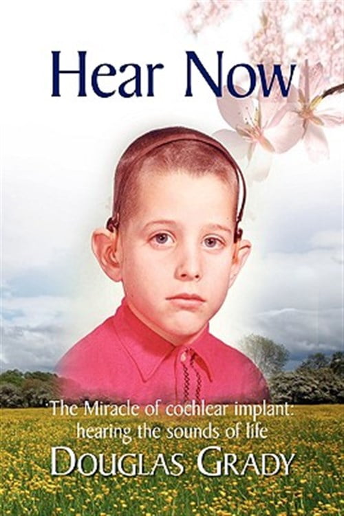 Pre-Owned Hear Now : The Miracle of Cochlear Implant, Hearing the Sounds of Life - Walmart.com