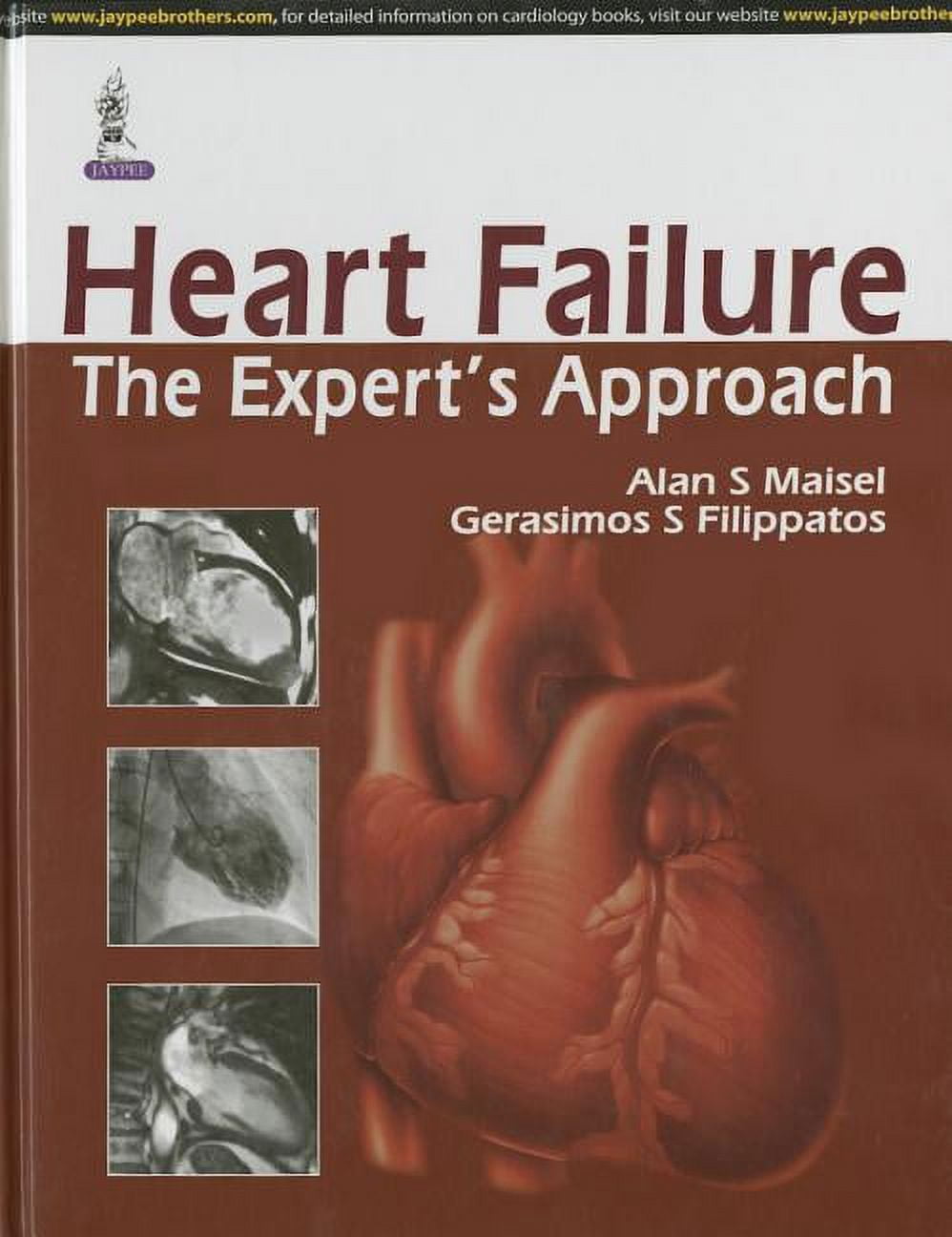 Heart Failure: The Expert's Approach (Hardcover) by Alan S Maisel ...