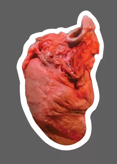 Heart Sticker Realistic Muscle Waterproof Sticker Phone Decal Water ...