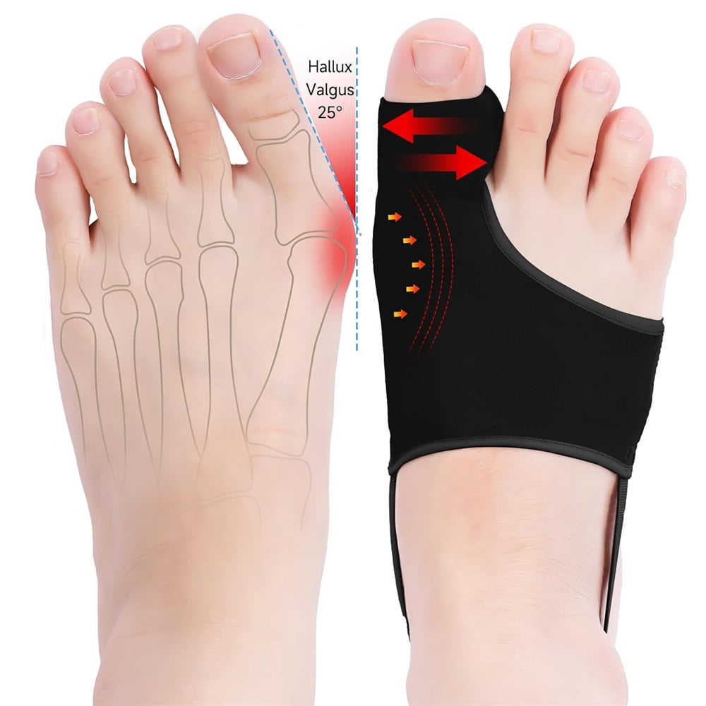 HeeHom Bunion Corrector Splint - Ergonomic Big Toe Support Brace with ...