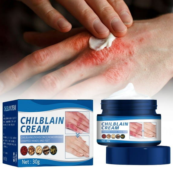 Heel & Hand Repair Balm - Moisturizing Skin Balm, 1.8oz, Shea Butter ...