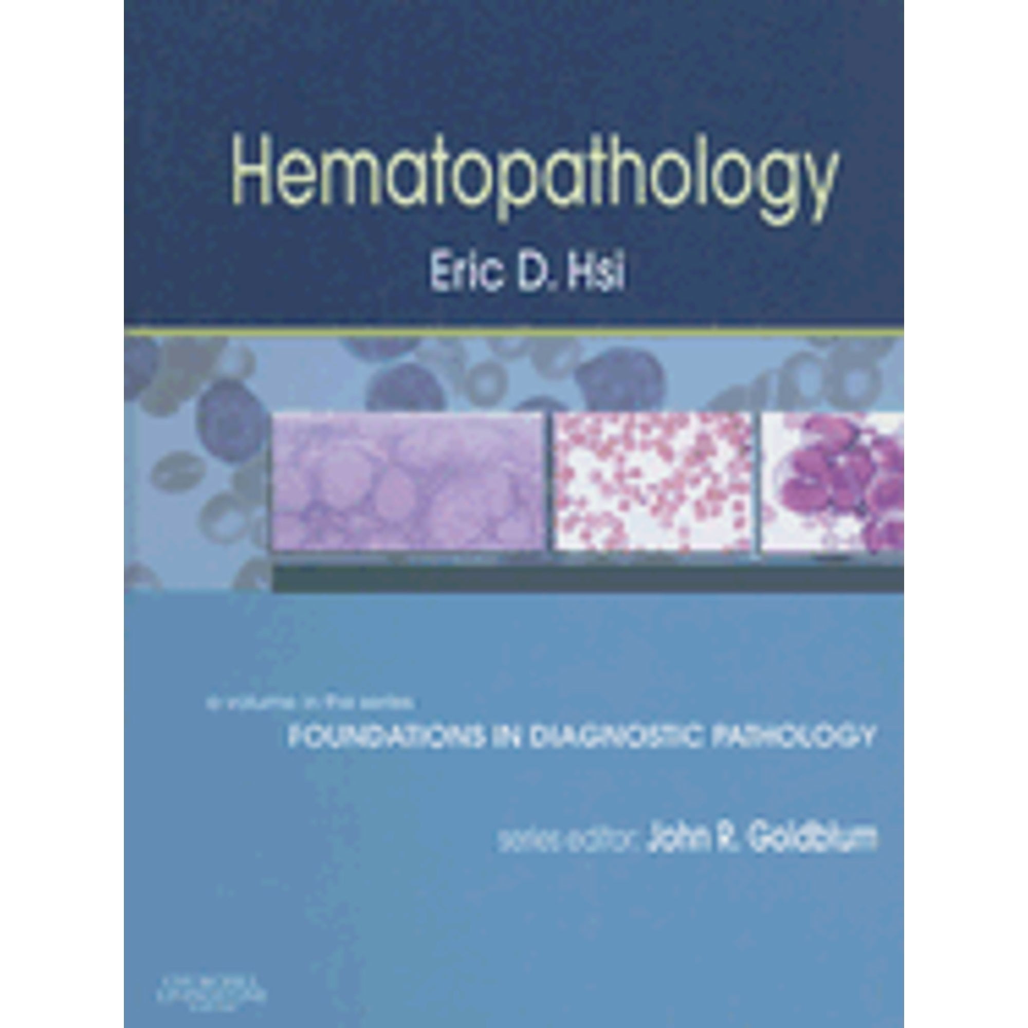 Hematopathology (Hardcover) by Eric D Hsi - Walmart.com