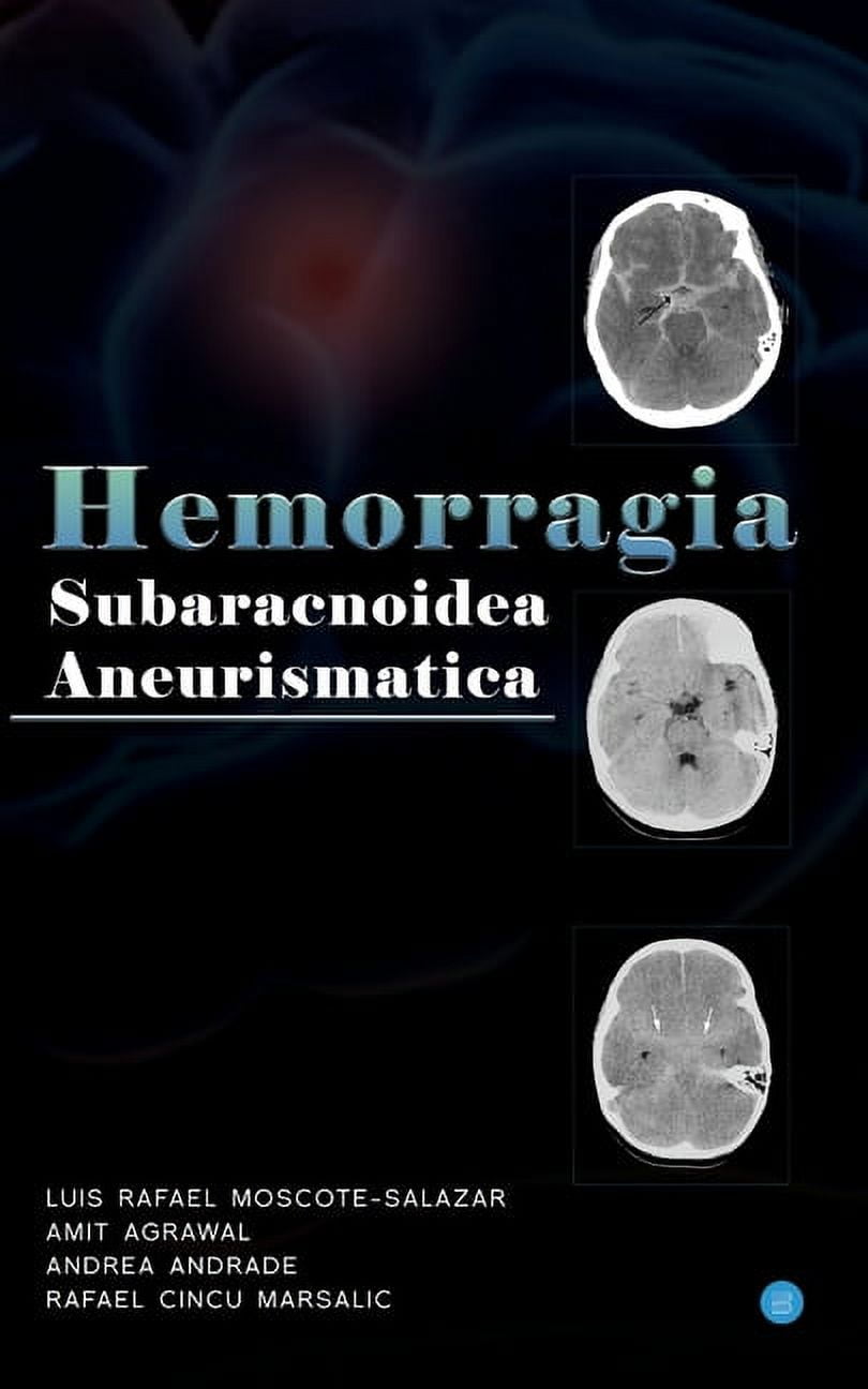Hemorragia Subaracnoidea Aneurismatica (Paperback) - Walmart.com